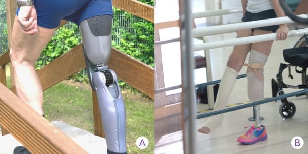 Lower Limb Prosthesis 101: Knowledge is Power - Sheltering Arms Institute